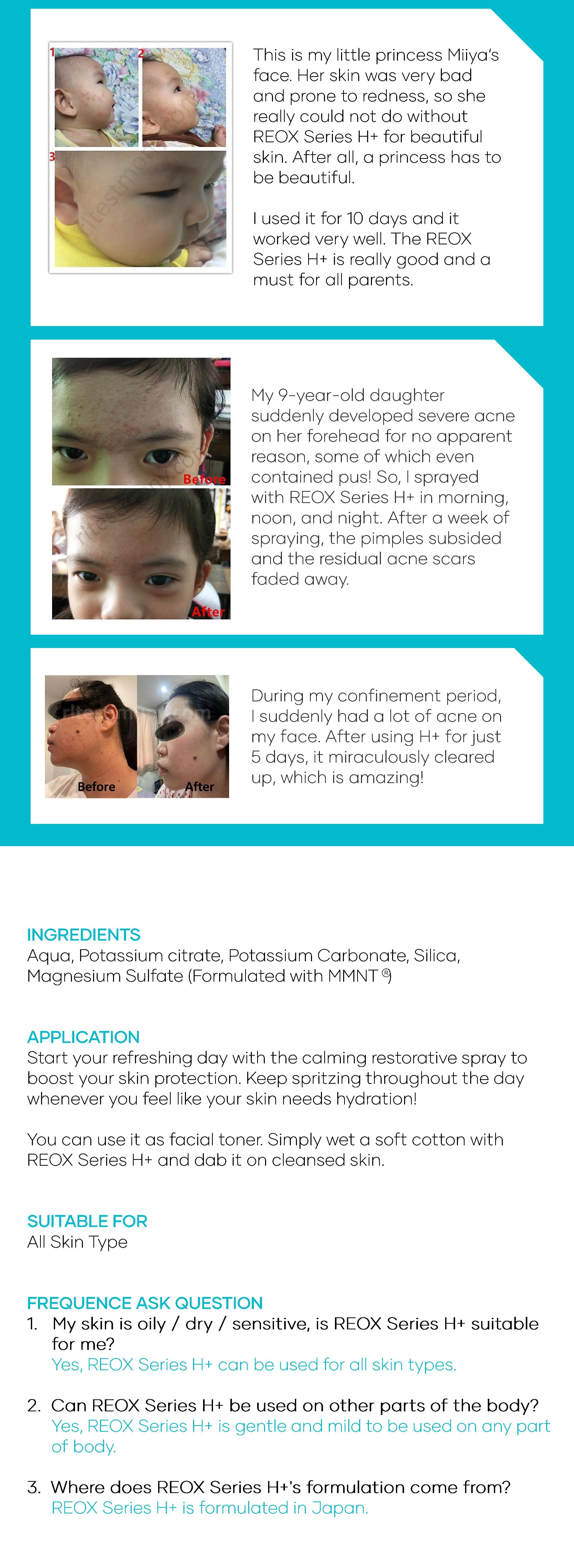 REOX Series H+ 135ML - Return Legacy